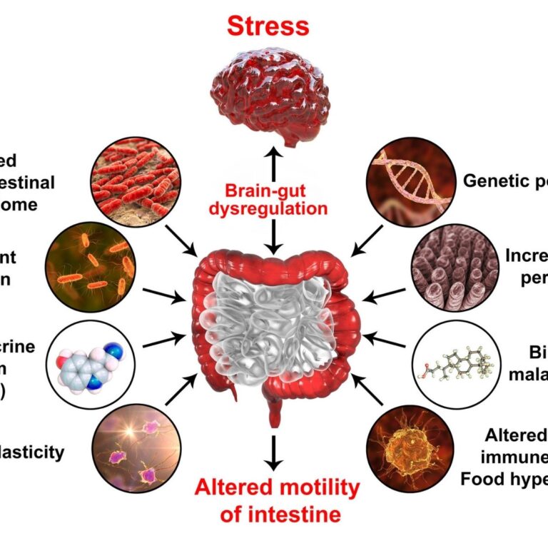 The Gut Brain Axis & What to Eat to Boost Your Mood - EA Stewart, RDN